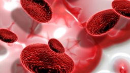 Scurvy: A Comprehensive Guide to Vitamin C Deficiency