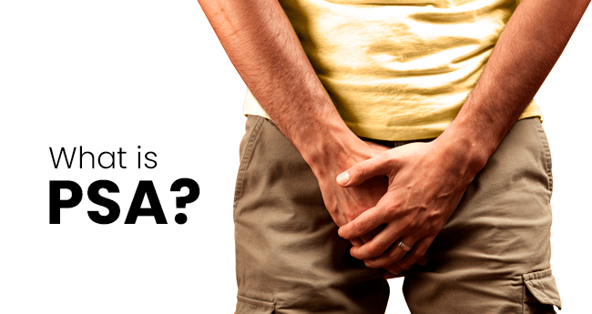 Who Needs a PSA Test? Normal Levels and Guidelines